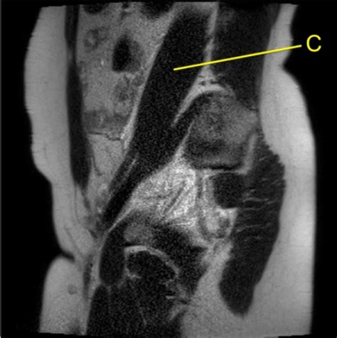 Mock Registry MRI I Flashcards Quizlet