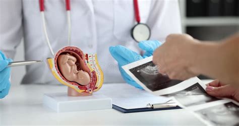 Doctor Reads Ultrasound Scan Of Healthy Pregnant Woman During Pregnancy
