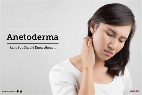 Anetoderma Facts You Should Know About It By Dr Sangeeta Varma