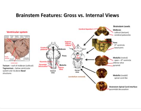 Lecture Intro To Brainstem Flashcards Quizlet