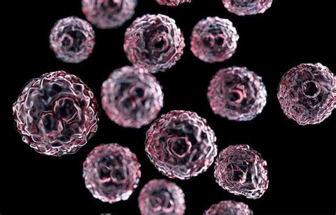 Sylvester Researchers Develop Nanoparticles To Tackle Brain Metastases