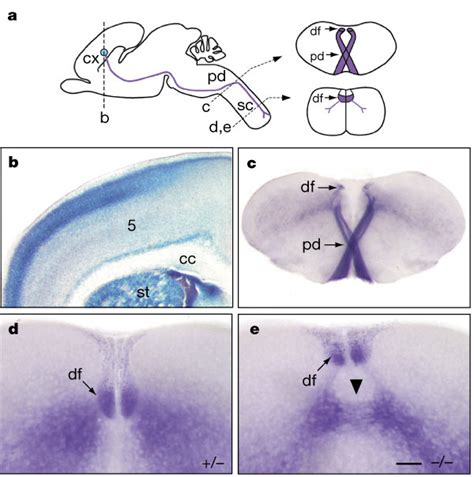 Axon Guidance Defects In Epha4 Mutantsa The Mouse Corticospinal Tract