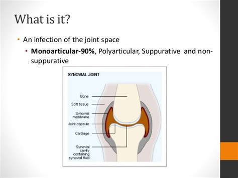 Paediatric Septic Arthritis