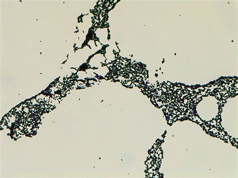 Micrograph Candida Albicans Gram Stain 100x P000021 Oer Commons