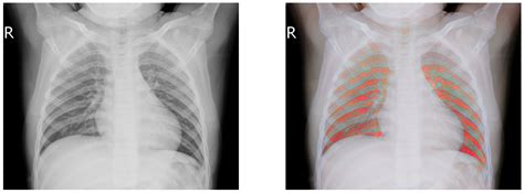 x ray colorization and neural networks by erica gabriel medium