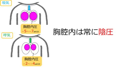 胸腔ドレナージ（チェストドレーンバック）の管理 ～ポイントを分かりやすく解説～ Icu看護師ダンカンの心外ブログ