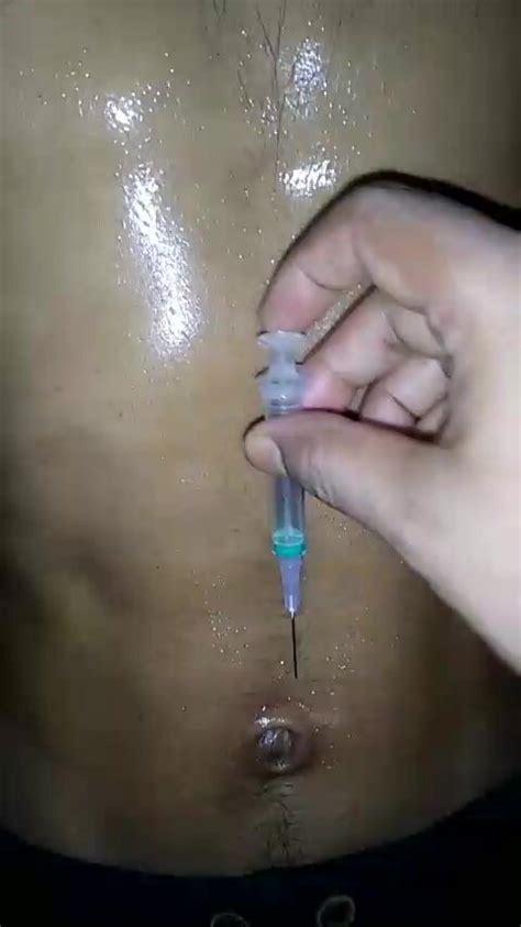 Abdomen Injection Needle Pierce