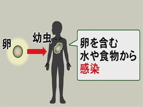 犬→ヒト感染で命に関わる事も愛知・知多半島の野犬に広がる“エキノコックス” 愛犬家「他人事ではない」 東海テレビnews