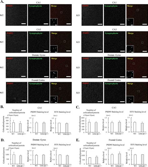 Analysis Of Immunofluorescence Staining In Hippocampal Substructures
