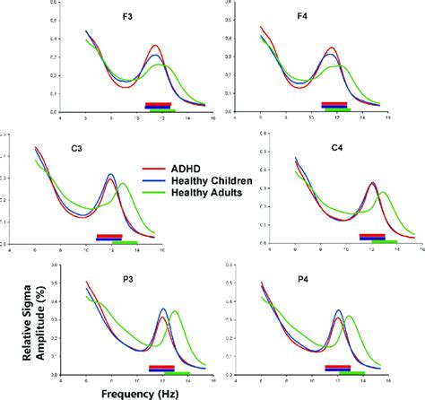 Plots Of Averages Of Relative Power Spectra Depicted From To Hz Download Scientific