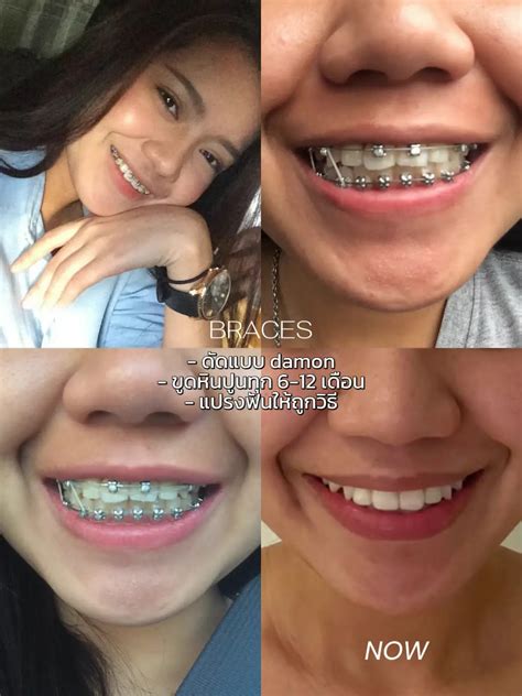 How To เปลี่ยนแปลงตัวเองให้เป็นเราในเวอร์ชั่นที่ดีขึ้น🫶🏼 แกลเลอรีที่