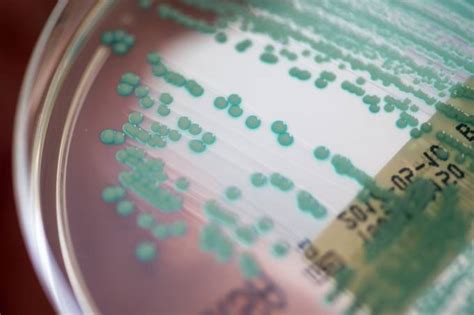 “superbactérias” Resistentes Poderão Matar Até 10 Milhões Em 2050