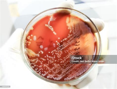 Staphylococcus Aureus Grampositive To Gramvariable Nonmotile Coccus