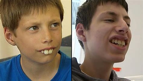 Buck Teeth People