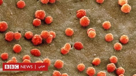 Sexually Transmitted Infections Types Symptoms And Prevention
