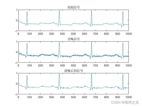 【心电信号】基于matlab小波阙值心电信号去噪【含matlab源码 2188期】小波阈值降噪matlab Csdn博客