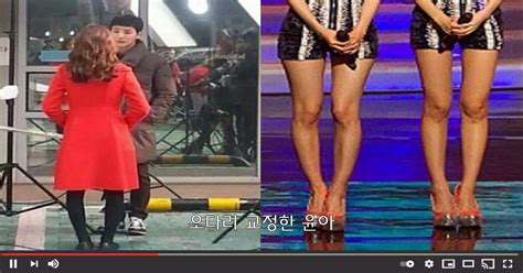 오다리 교정한 윤아 Fun