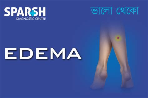 Edema Sparsh Diagnostic Center