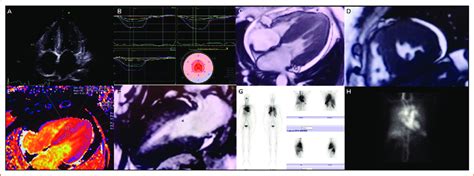 Diagnostic Work Up In Patients With Hfpef Download Scientific Diagram