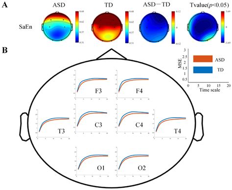 Comparison Of Eeg Complexity Differences Between The Two Groups Of Download Scientific Diagram