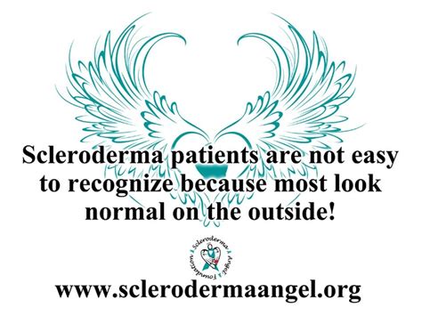 Saf Awareness Sign Scleroderma Scleroderma Awareness Invisible