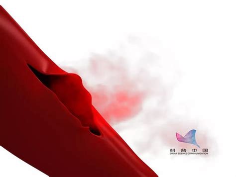 为什么有些人割腕会死，武松断了整条胳膊却没事？答案原来不简单