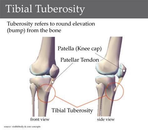 Tibial Tuberosity Patrick Ersig Flickr