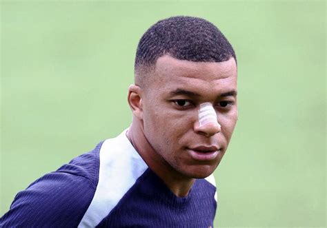 Mbappé Reapareció Con Un Apósito En Su Nariz Durante Los Entrenamientos