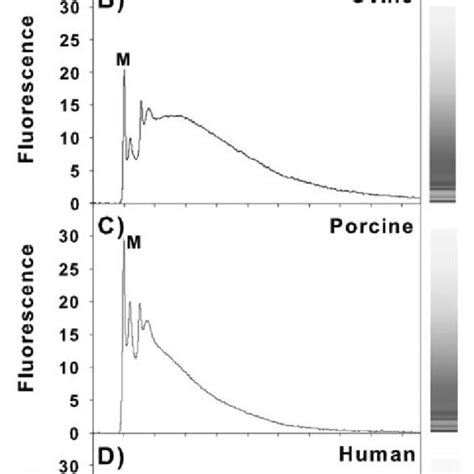 Representative Electropherograms Of Total RNA From Sperm Note The Lack Download Scientific