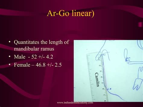 Cogs Analysis Cephelometrics For Orthognathic Surgery Fixed Orthodontics Courses India Ppt