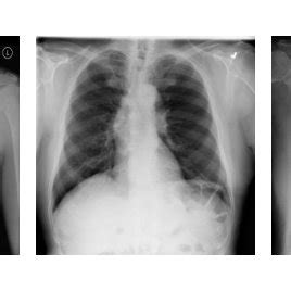 Sample Images In The Dataset Download Scientific Diagram