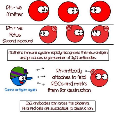 Rh Incompatibility Complications Causes Symptoms Dx Rx