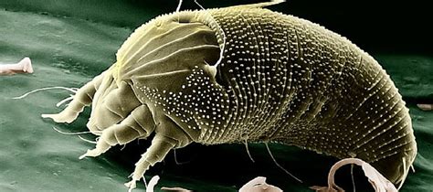 Can Pest Control Treat For Lice Scabies And Dust Mites ABC Home Commercial Services Blog