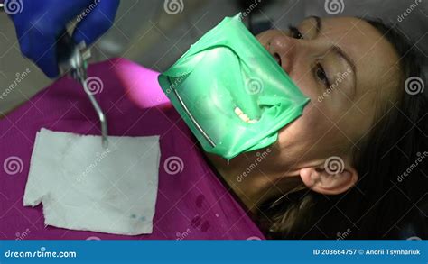 The Dentist Treats The Patient`s Teeth Uses A Rubber Dam For Quality