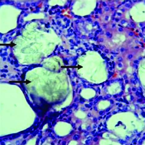 Electron Micrograph Showing Chronic Chromium Poisoning In Wistar Rats Download Scientific