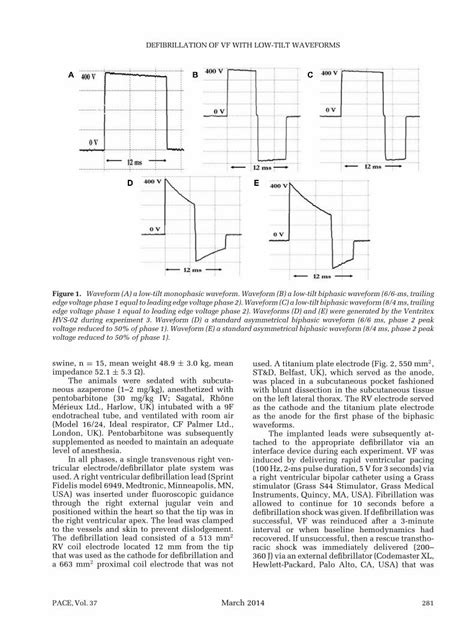 Pdf Low Tilt Monophasic And Biphasic Waveforms Compared With Standard