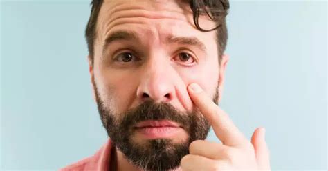 Understanding Viral Pink Eye Symptoms