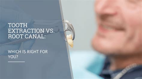 Tooth Extraction Vs Root Canal Which Is Right For You Eastern