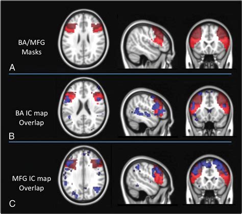 Inferior Frontal Gyrus Mri Table 11