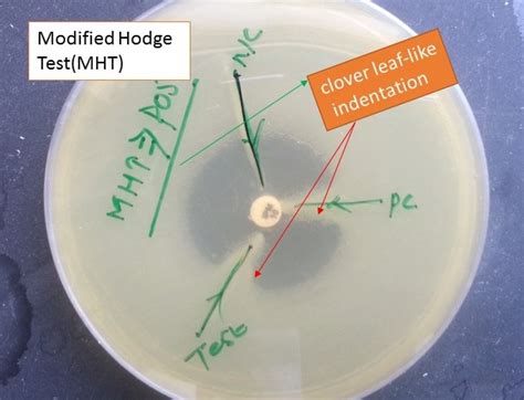 Modified Hodge Test For Carbapenemase Detection Principle Procedure