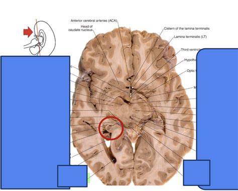 Hippocampus Study Set Terms Definitions Flashcards Quizlet