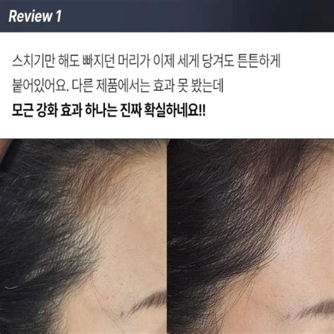 트리코닉스 트리코엑스 두피 앰플 내돈내산 후기 가격 효과 사용법
