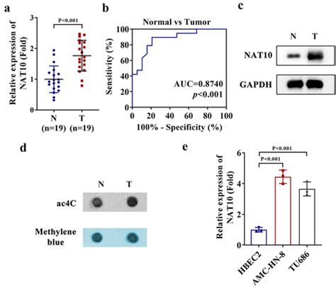 Full Article Nat10 Promotes The Tumorigenesis And Progression Of