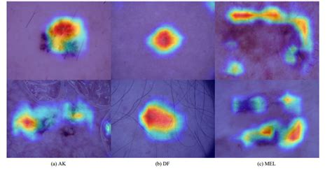 Mdkloss Medicine Domain Knowledge Loss For Skin Lesion Recognition