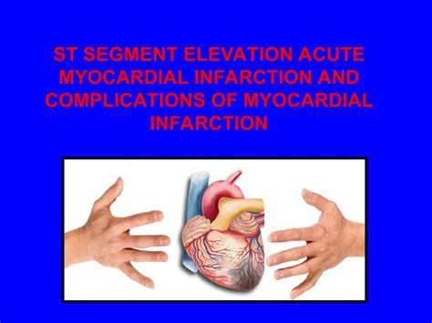 St Segment Elevation Acute Myocardial Infarction And Complications Of Myocardial Infarction