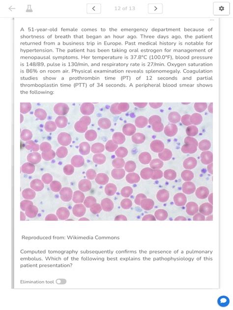 Osmosis 42 Pdf Anemia Clinical Medicine