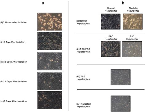 Morphology Of Primary Human Hepatocytes After Isolation In Culture A