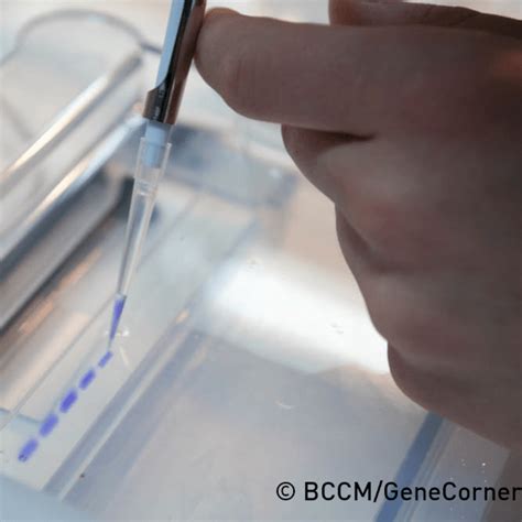 Plasmid Profile Analysis Mirri Eric