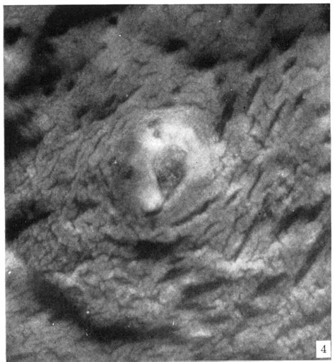 Carnegie Stage 5b 1 Surface View Of Implantation Site
