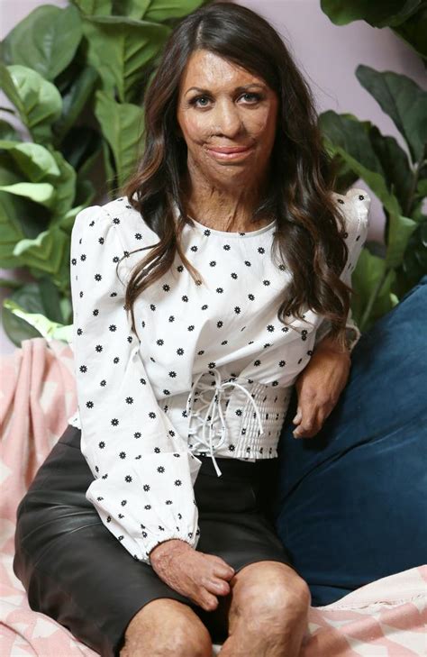 Turia Pitt Opens Up About Her Panic Amid The Bushfire Crisis News